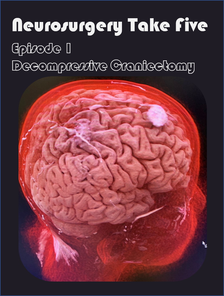 Episode 1
